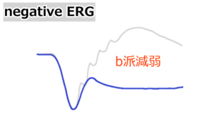 網膜電図（ERG）の基本と読み方まとめ | めだまにあ