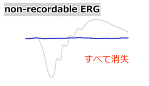 網膜電図（ERG）の基本と読み方まとめ | めだまにあ